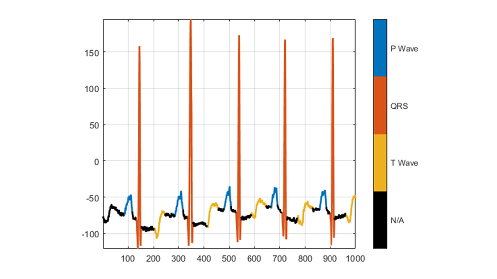 Signal Processing Toolbox Matlab